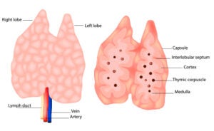 Thymectomy Resource Center | Myasthenia Gravis Foundation of America
