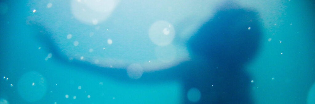 Jessica Collier is an MG Mermaid…and an Inspiration | Myasthenia Gravis ...